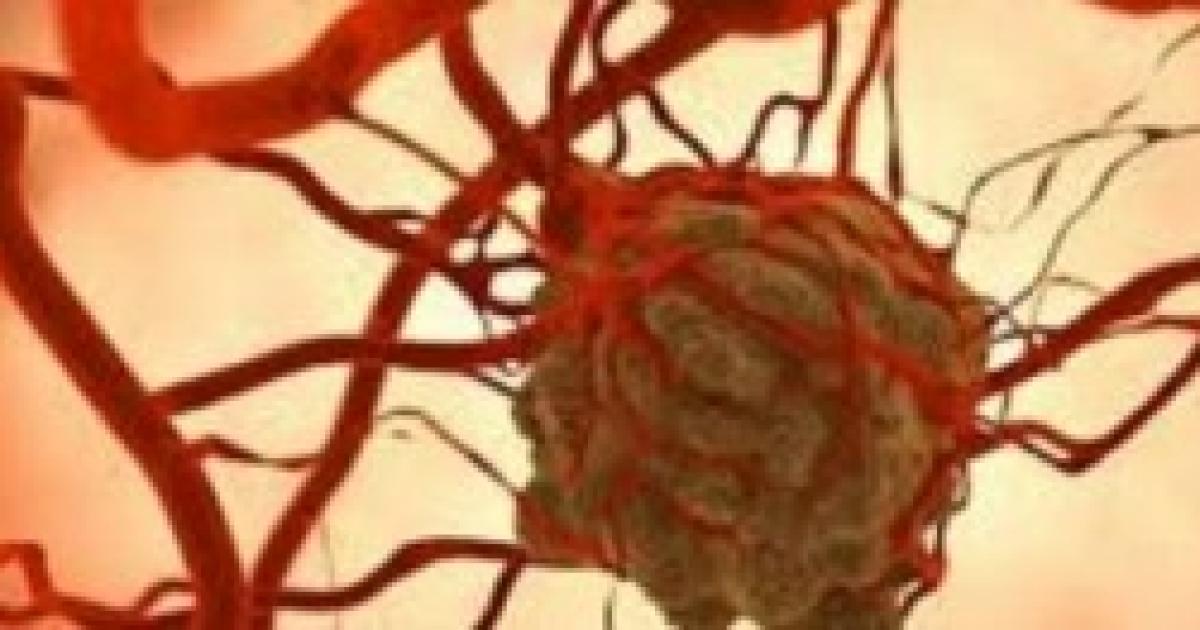 Una mutación genética protege a las mujeres latinas del cáncer de mama