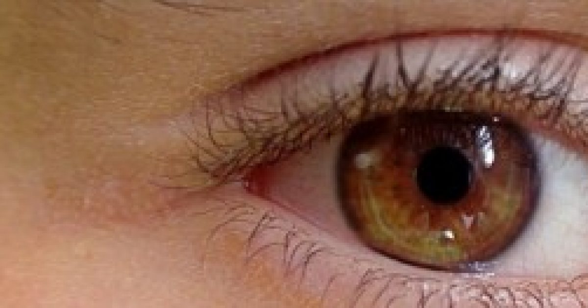 Microftalmia e Anoftalmia: tudo sobre a perda visual congênita