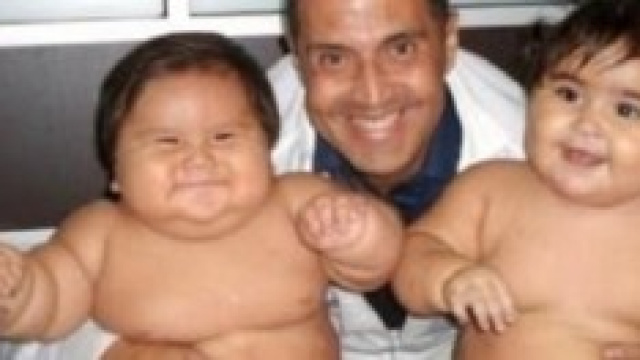 Colombia, record da shock: i bambini più grassi del mondo, a soli 10 ...