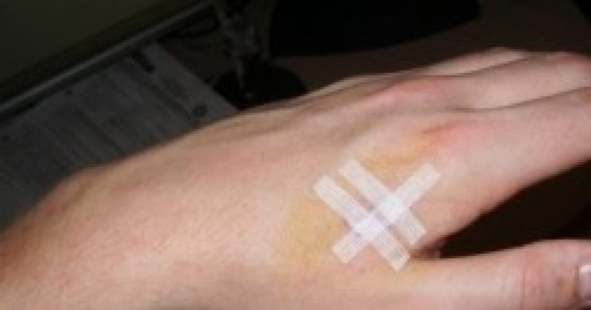 Chip RFID - A Marca da besta que será implantada em você.