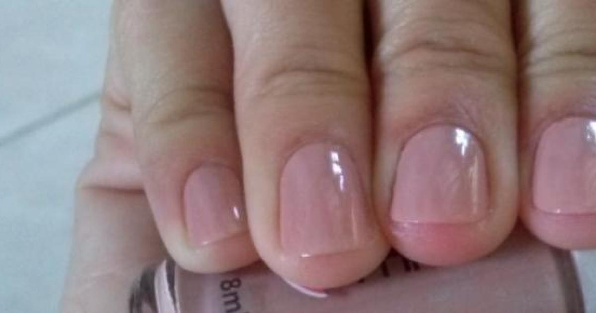 Unhas fracas e quebradiças: Culpa do esmalte?