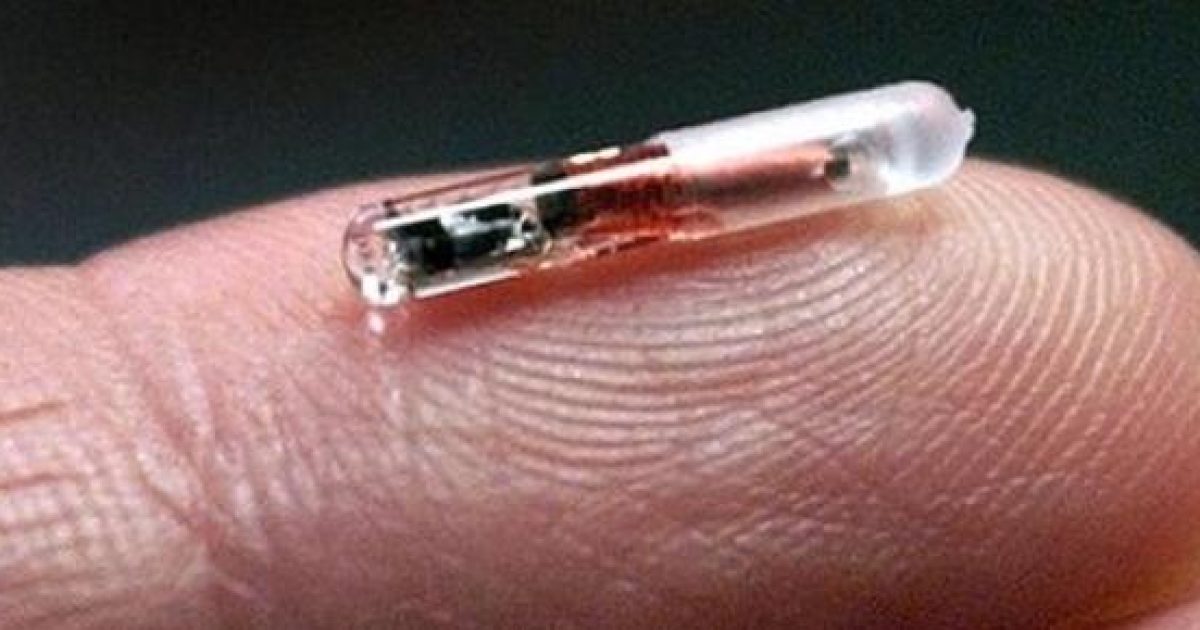 Implantes de microchips passam a ser aplicados em pessoas