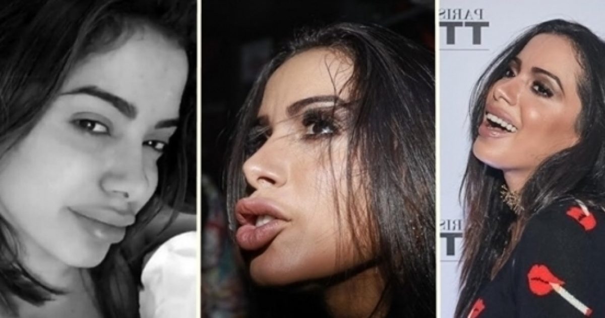 Veja o que a cantora Anitta fez, ao longo dos anos, para mudar tanto