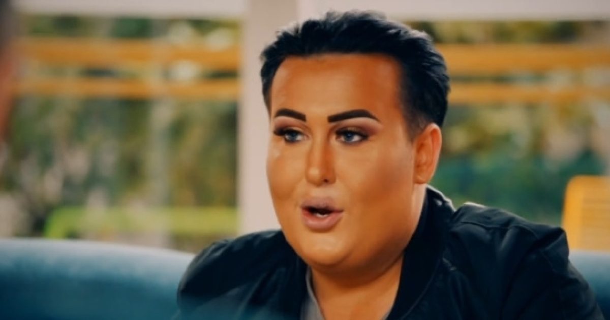Body Fixers star Henry Banham talks horrifying lip filler experience