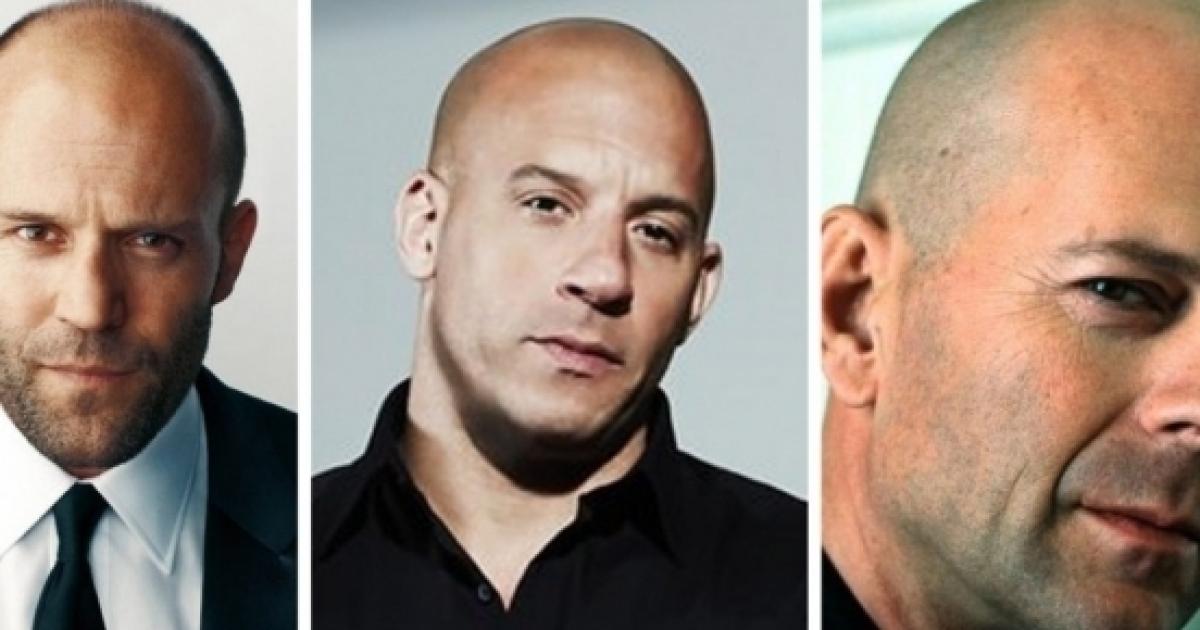 Pesquisadores revelam as vantagens proporcionadas pela calvície masculina