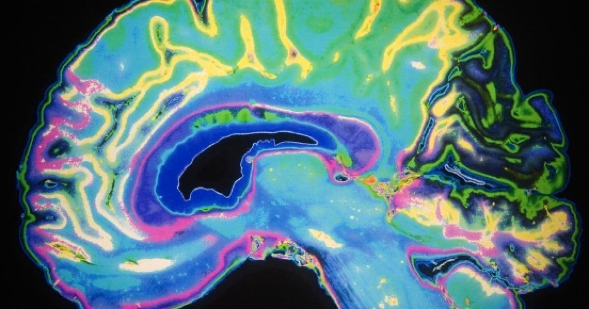 Brain scans may allow doctors to diagnose autism sooner