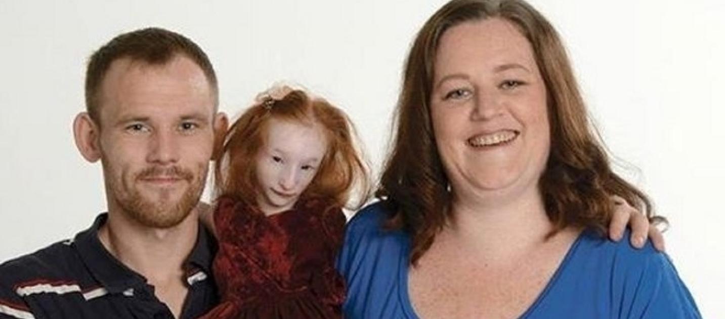 Connaissez-vous l'histoire de la plus petite fille du monde