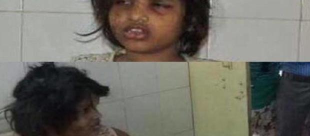 Mowgli Esiste Davvero In India Trovata Bimba Di Otto Anni Allevata Da