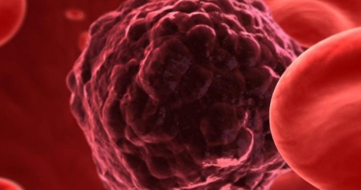 7 sintomas de câncer que você precisa estar atento