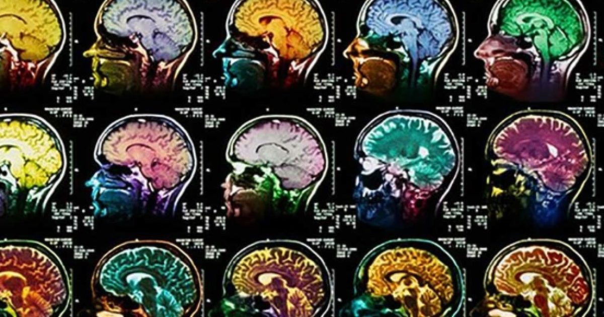 Research reveals which parts of the brain are used in dreaming