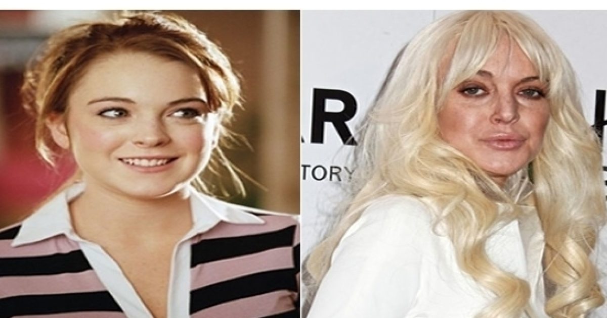 10 famosas que exageraram nas cirurgias plásticas e ficaram irreconhecíveis