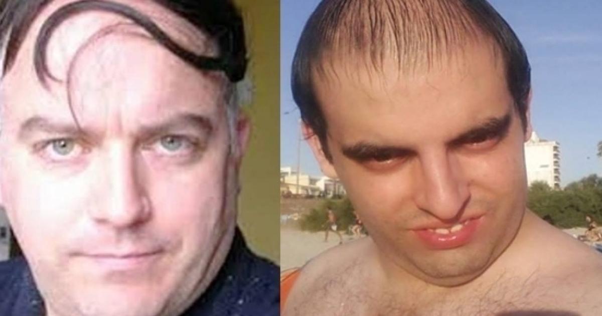 6 homens que falharam ao tentar esconder sua calvície