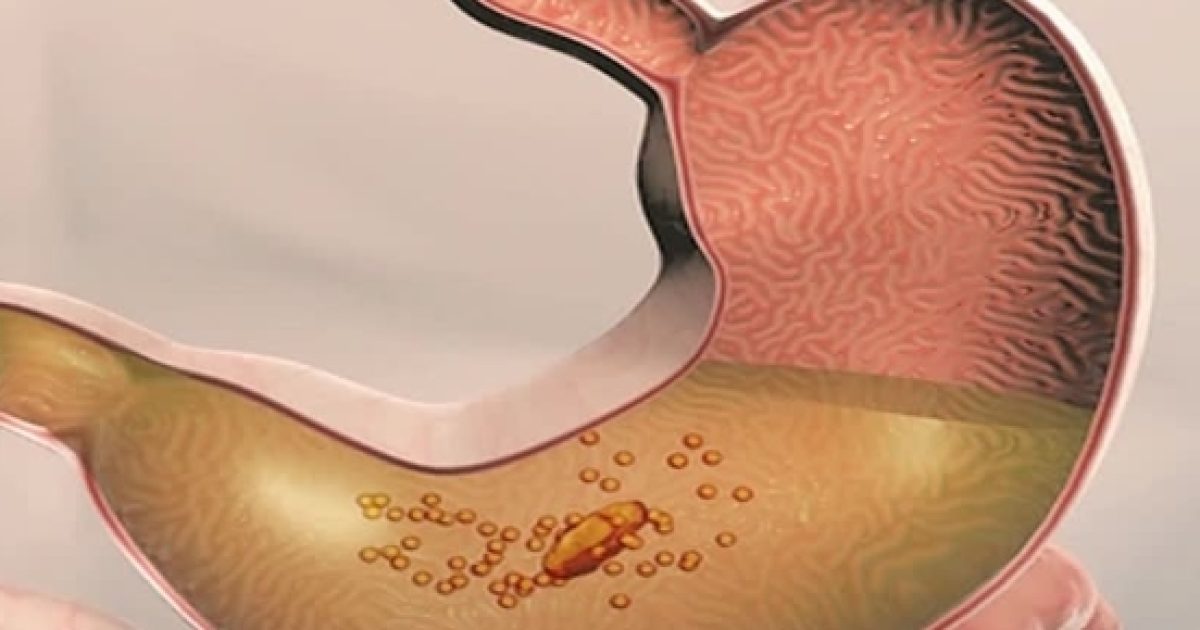 ¿Qué es el quimo y cuál es su función?