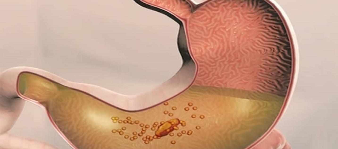 ¿Qué es el quimo y cuál es su función?