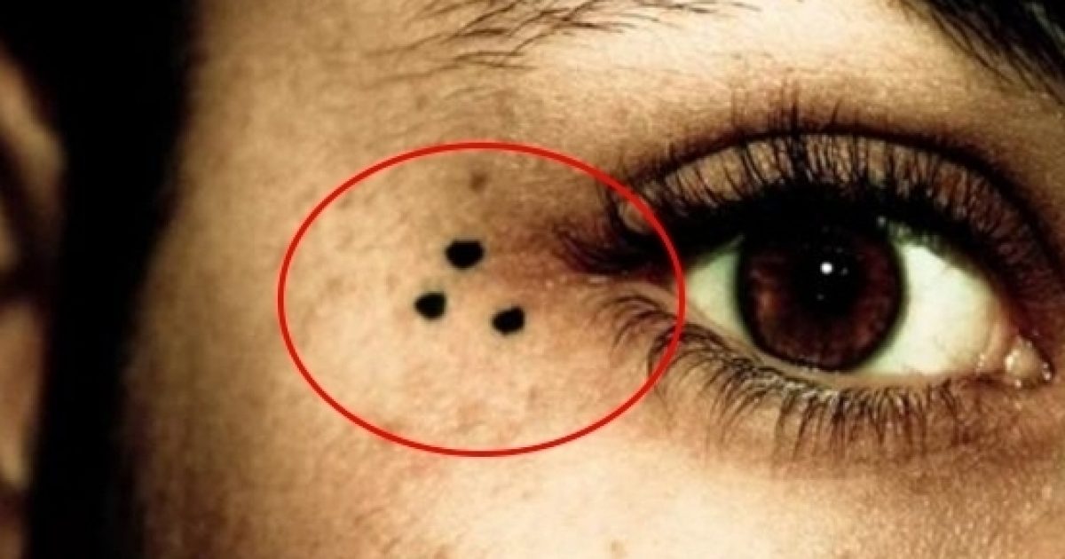 Você conhece alguém que tem três pontos no rosto? Tome cuidado; veja o ...