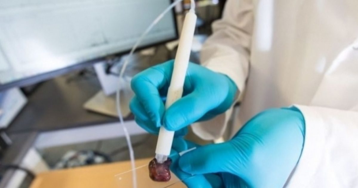 This pen-sized device can identify cancer in 10 seconds