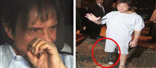 Após ter perna amputada, foto de Roberto Carlos viraliza? Saiba tudo