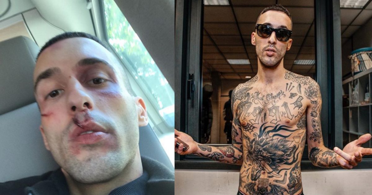 Jamil e la foto dove sembra essere stato picchiato: i presunti ...