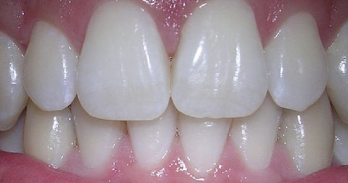 Cellule staminali: nuove applicazioni per curare i denti