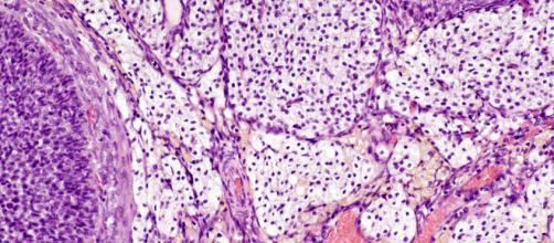 Abbiamo un organo nuovo che si chiama interstizio
