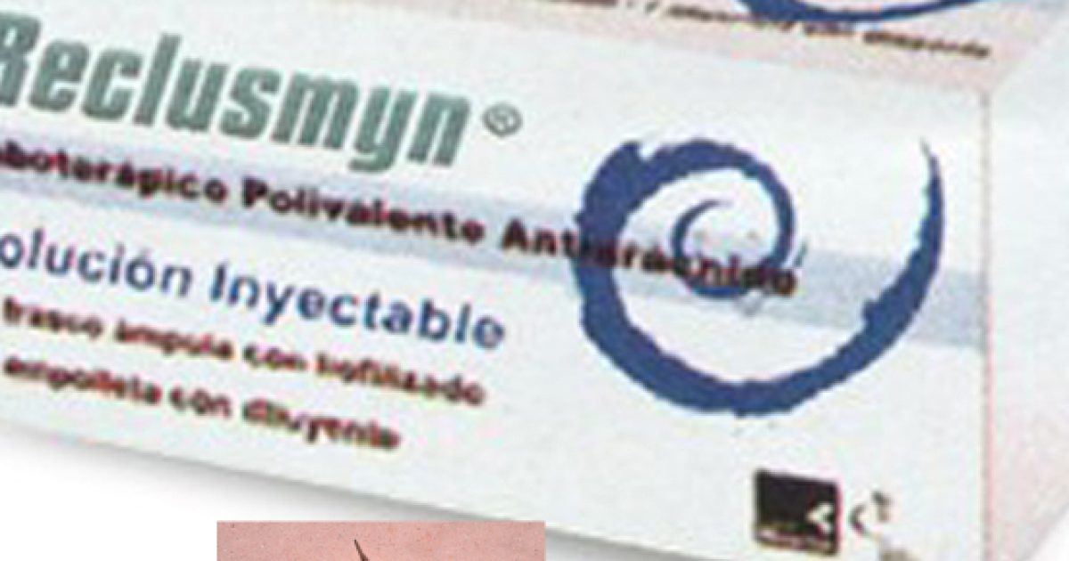 Contro la tossicità del ragno violino il Messico contrappone il siero ...