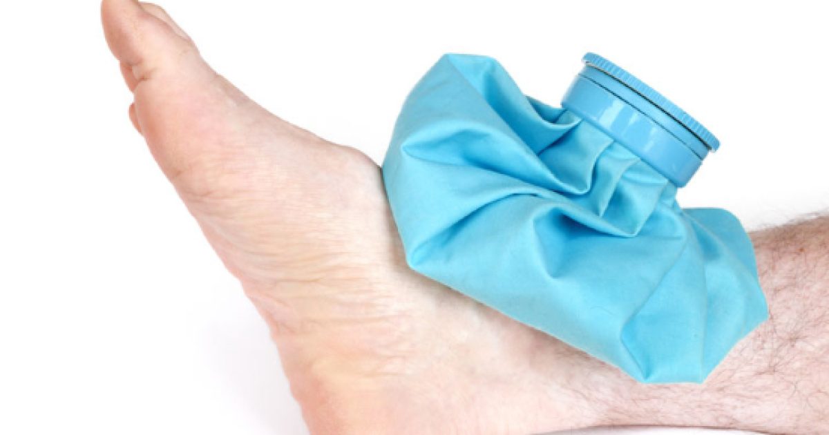 Cómo calmar golpes y torceduras