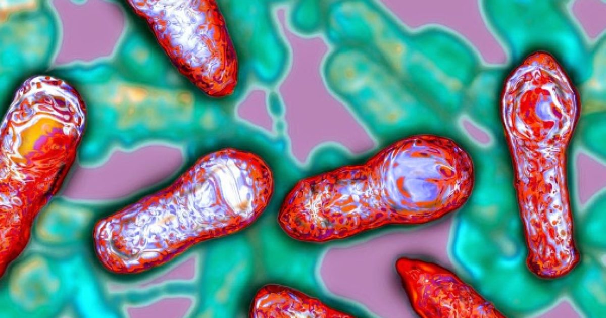 El botulismo: una fatal intoxicación alimentaria