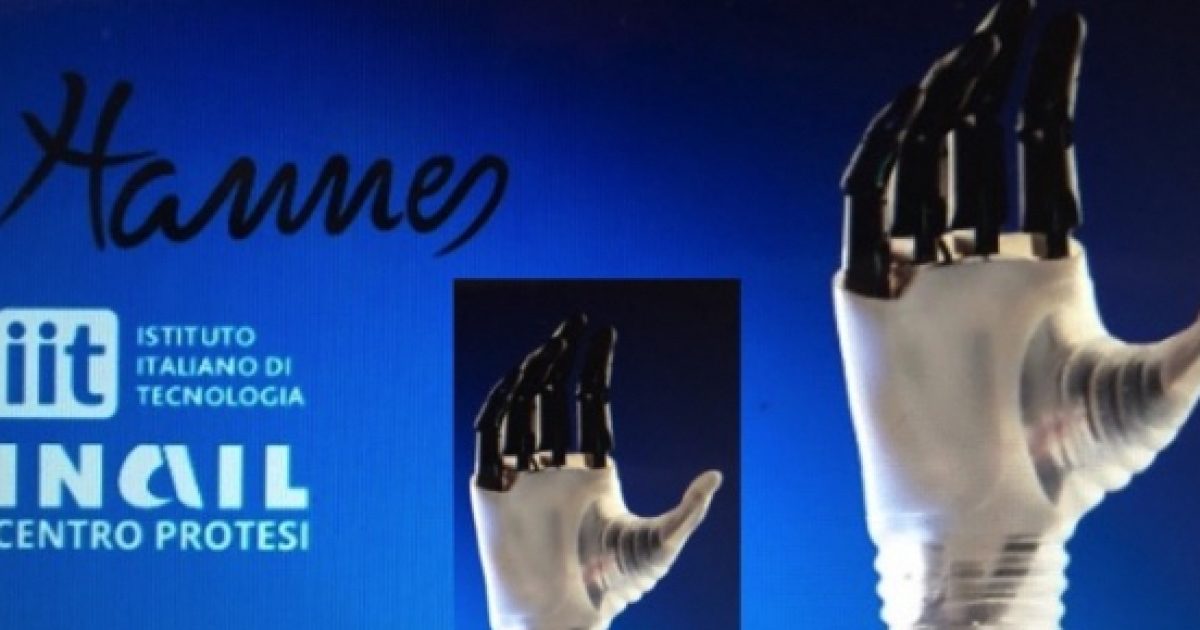 Mano bionica, sanità e tecnologia del futuro per una nuova vita