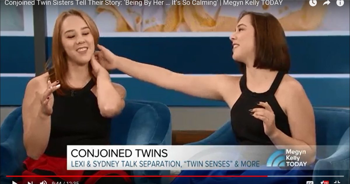 Successfully separated conjoined twins appear on Megyn Kelly TODAY