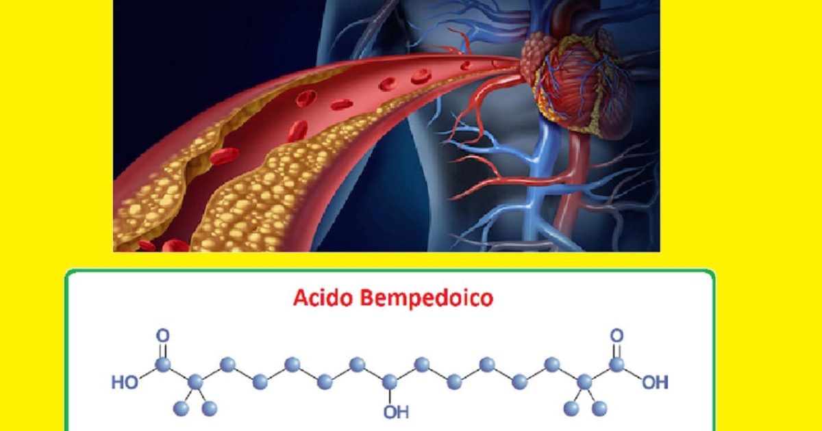 Philadelphia: l’acido bempedoico riduce il colesterolo-LDL anche nei ...