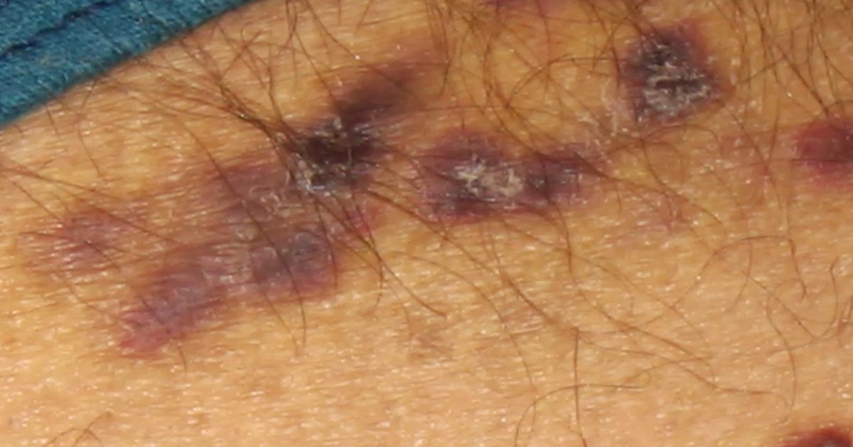 10 fatos sobre o vírus da Aids