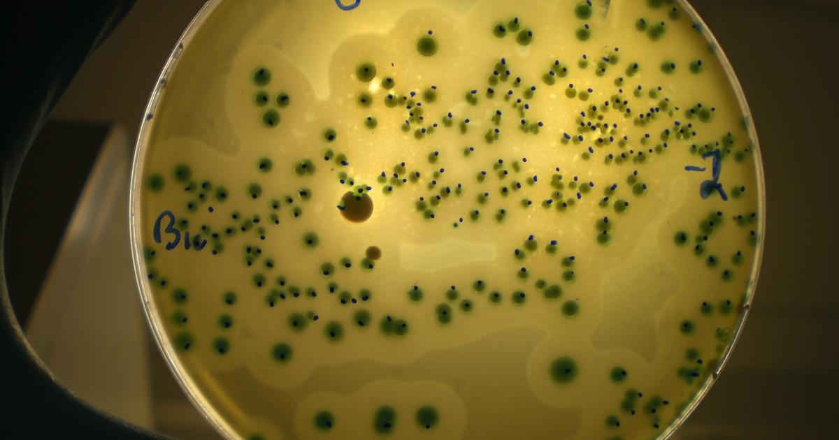 5 bacterias muy comunes en los alimentos - 4