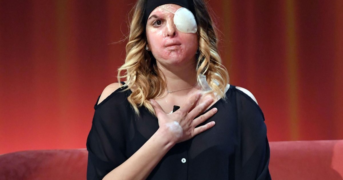 Festival di Sanremo: Gessica Notaro sarà ospite della prima serata