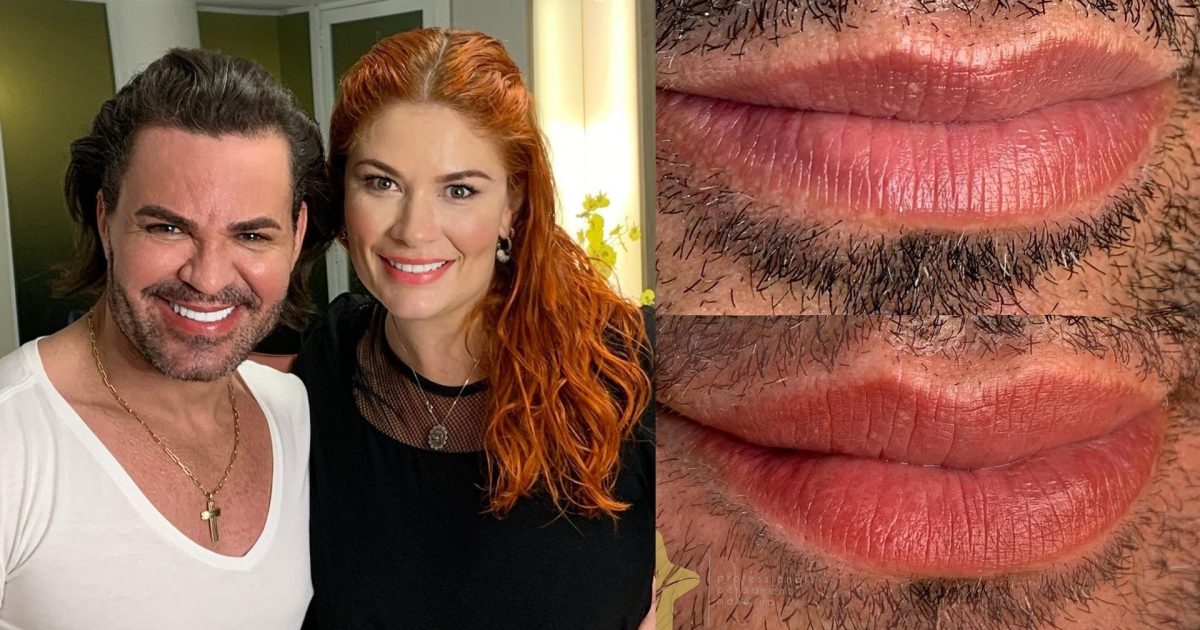 5 famosos que passaram por transformações após cirurgias plásticas