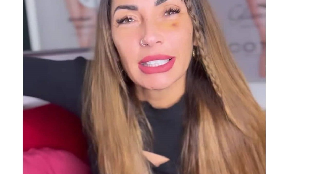 Uomini e Donne, Ida con un livido sotto l'occhio: 'Ho preso uno spigolo, nulla di grave'